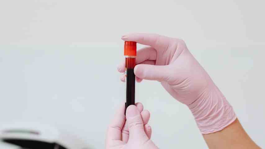 mchc blood test Details - Mean Corpuscular Hemoglobin